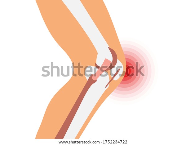 Joint Pain Illustration Bone Pain Ache Stock Vector (Royalty Free ...