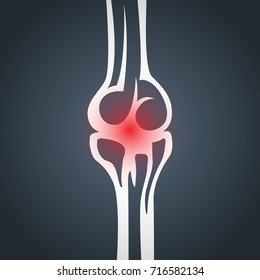 Joint Pain Vector Icon Illustration Stock Vector (Royalty Free ...