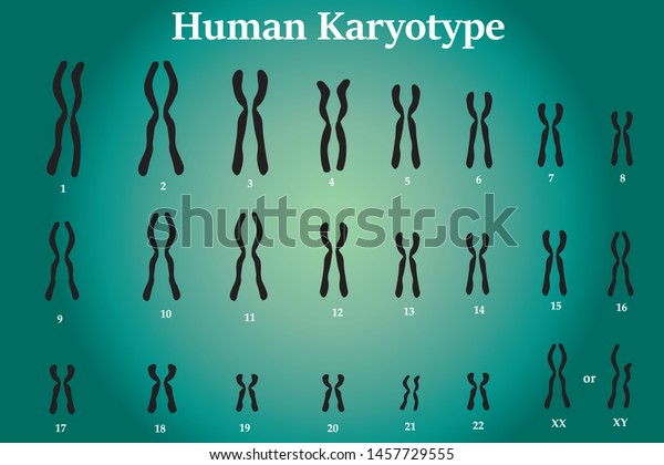 Karyotype Normal Human Chromosome Illustration Vector Stock Vector ...