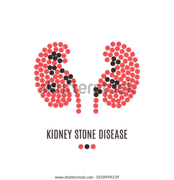 Kidney Stone Disease Awareness Poster Kidneys Stock Vector (Royalty ...