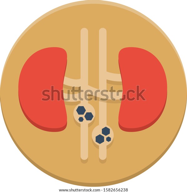 Kidney Stone Vector Icon Badge Illustration Stock Vector (Royalty Free ...