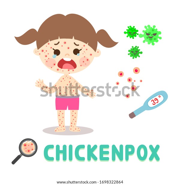 Kids Have Chickenpox Virus Vector Stock Vector (Royalty Free ...