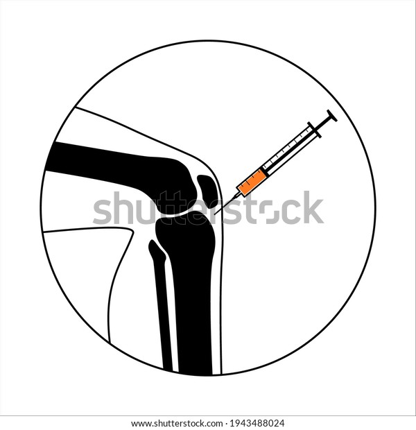Knee Injection Concept Disease Osteoporosis Arthritis Stock Vector ...