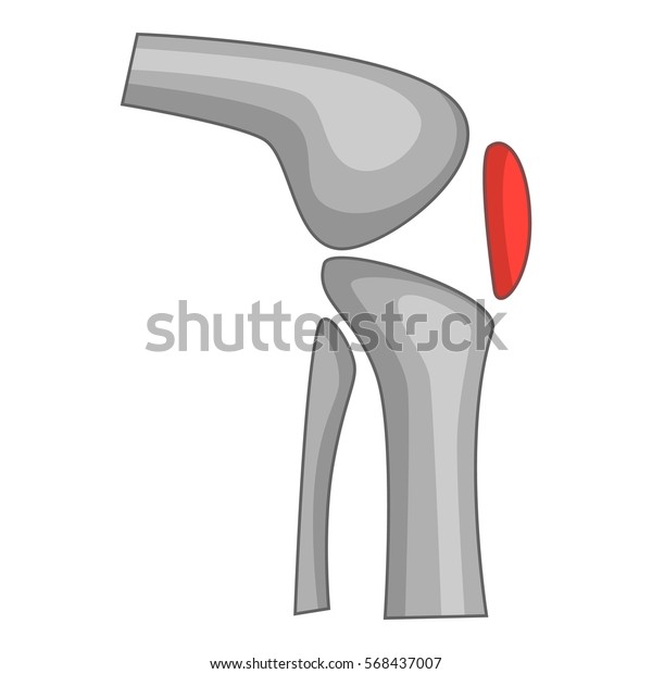 Knee Replacement Implant Icon Cartoon Illustration Stock Vector ...