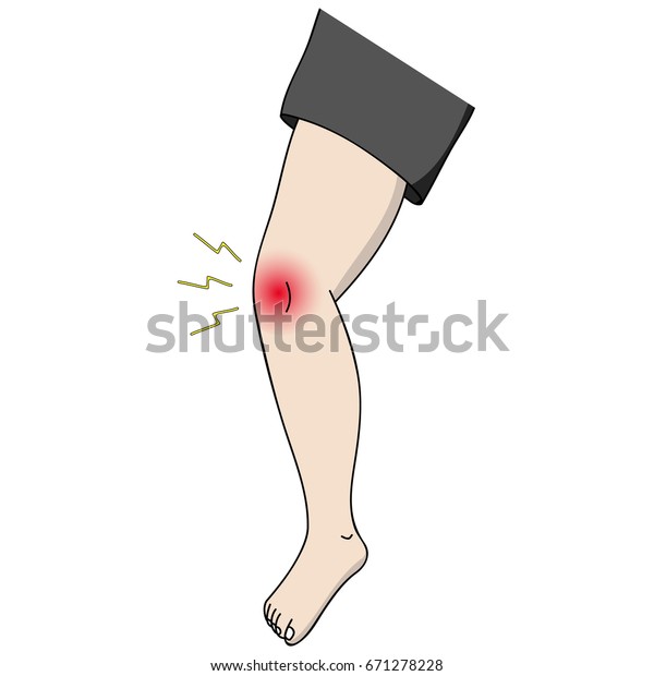 Knees Red Bruised Because Injuryhand Drawnvectorillustration Stock ...