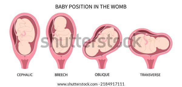 504 Birth Canal Images, Stock Photos & Vectors | Shutterstock