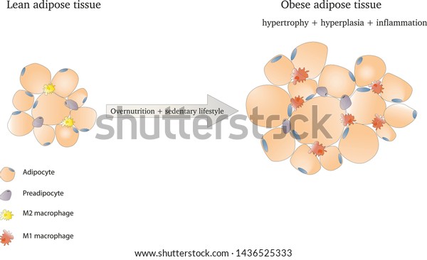 Lean Obese Adipose Tissue Stock Vector (Royalty Free) 1436525333 ...
