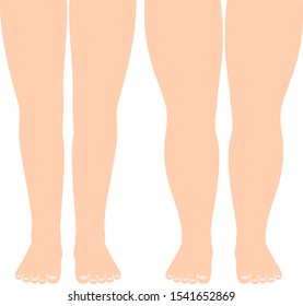 Legs Standard Size Fat Legs Stock Vector (Royalty Free) 1541652869 ...
