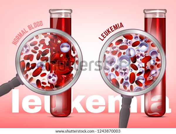 Leukemia Horizontal Poster Bright Colors White Stock Vector (Royalty ...