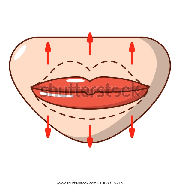 Lip Augmentation Icon Cartoon Illustration Lip Stock Vector (Royalty ...