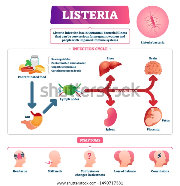 Listeria Vector Illustration Labeled Educational Foodborne Stok Vektör ...