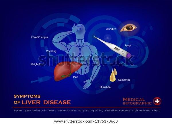 Liver Disease Infographic Stock Vector (Royalty Free) 1196173663 ...