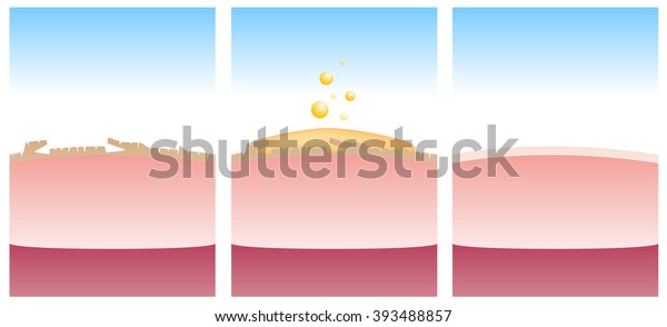 Lotion That Delete Dead Skin Make Stock Vector (Royalty Free) 393488857 ...