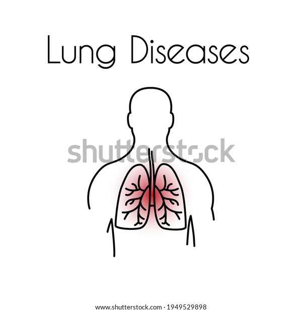 Lung Diseases Linear Icon Vector Minimal Stock Vector (Royalty Free ...