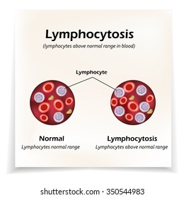 What Is The Normal Range Of Eosinophils In Blood