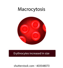 Macrocyte Stock Vectors, Images & Vector Art | Shutterstock