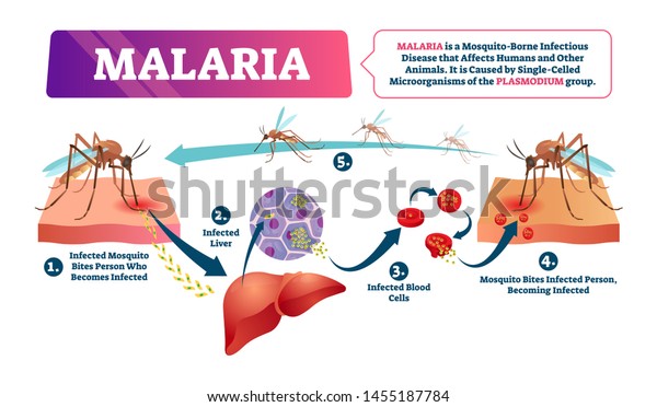Malaria Vector Illustration Labeled Mosquito Bite Stock Vector (Royalty ...