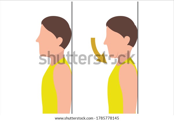 Man Doing Chin Tuck Stretches Poses Stock Vector (Royalty Free ...