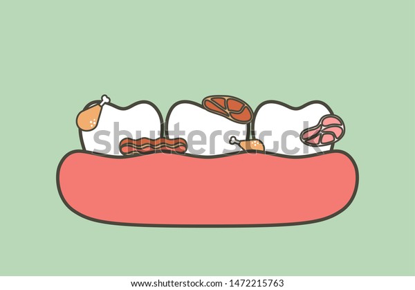 Meat Stuck Teeth Cause Decay Tooth Stock Vector (Royalty Free ...