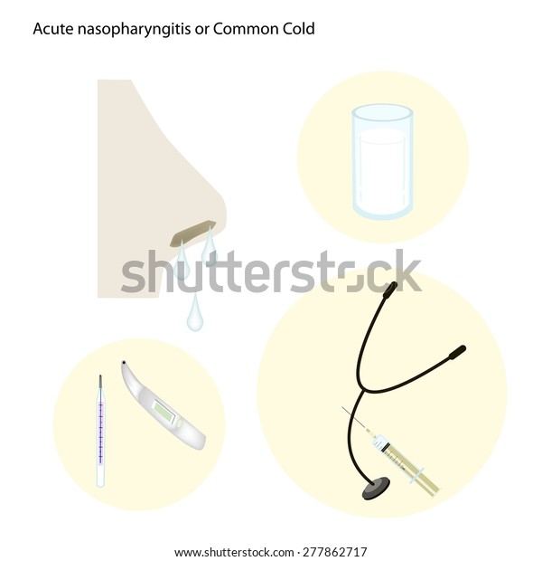 Medical Concept Illustration Common Cold Nasopharyngitis Stock Vector ...