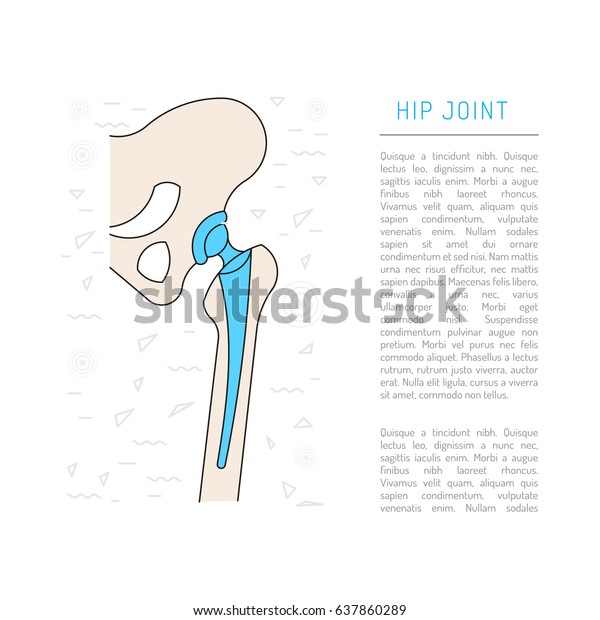 Medical Illustration Structure Bones Hip Joint Stock Vector (Royalty ...