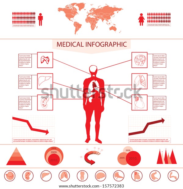 Medical Information Graphic Stock Vector (Royalty Free) 157572383 ...