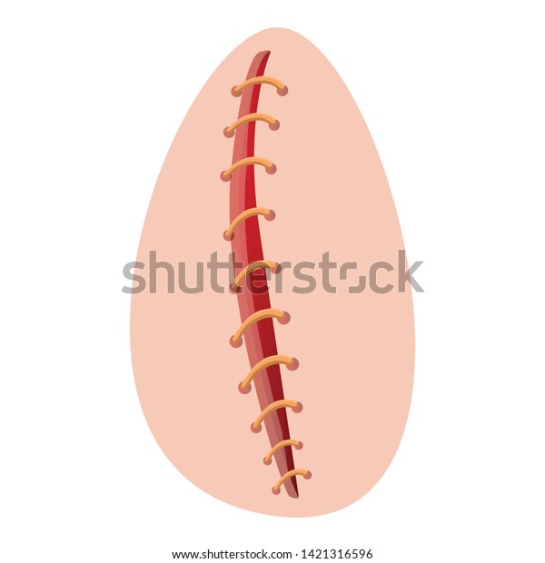Medical Stitches Vector Icon Cartoon Illustration Stock Vector (Royalty ...
