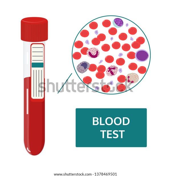 Medical Vector Concept Blood Analysis Test Stock Vector (Royalty Free ...