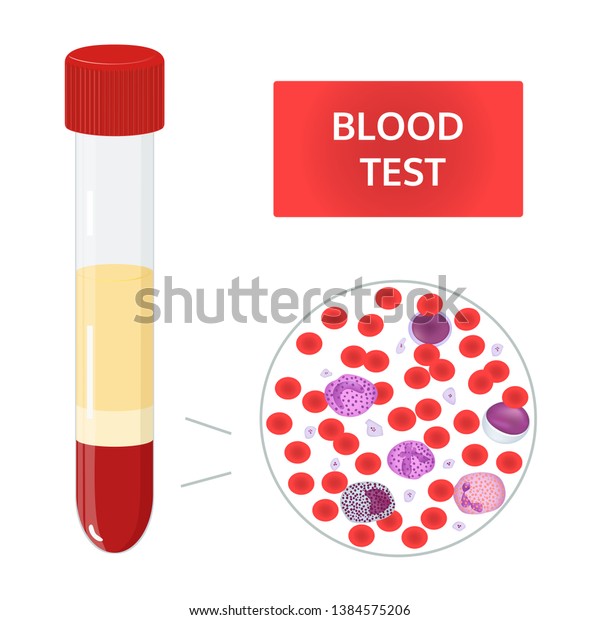 Medical Vector Concept Blood Analysis Test: Vector có sẵn (miễn phí bản ...