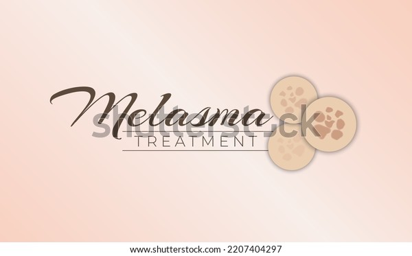 Melasma Treatment Banner Background Vector Design Stock Vector (Royalty ...