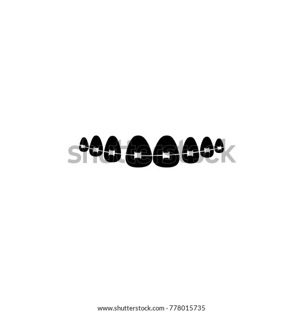 Metal Dental Braces Types Dental Braces Stock Vector (Royalty Free ...