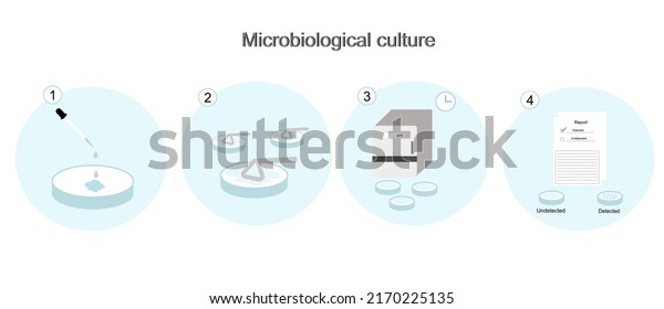 Methodology Microbiological Culture Spread Plate Technique: เวกเตอร์ ...