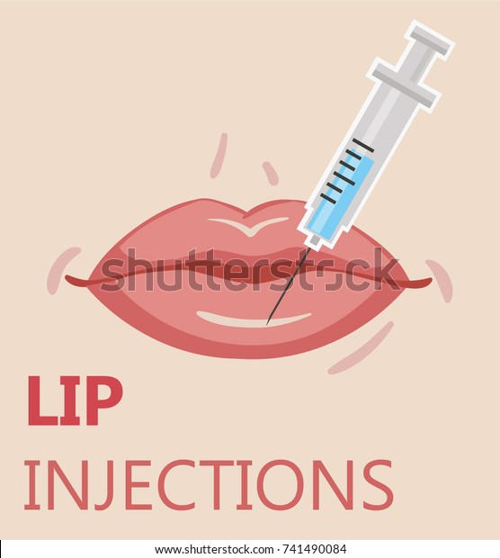Modern Vector Illustration Lips Injections Lip Stock Vector (Royalty ...