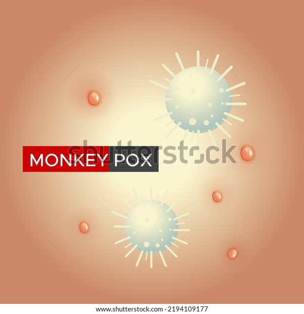 Monkeypox Skin Rashes Spots Symptoms Icon Stock Vector (Royalty Free ...
