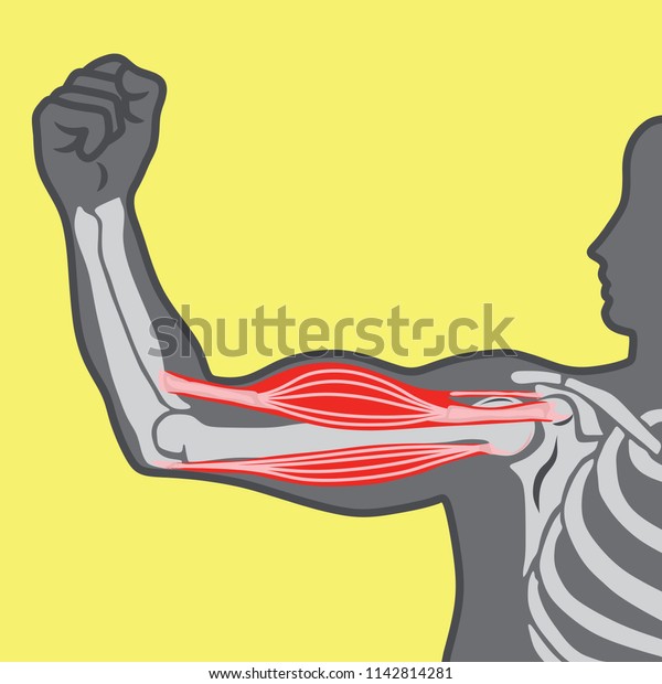 Muscle Power Sectioned Vector Illustration Arm Stock Vector (Royalty ...