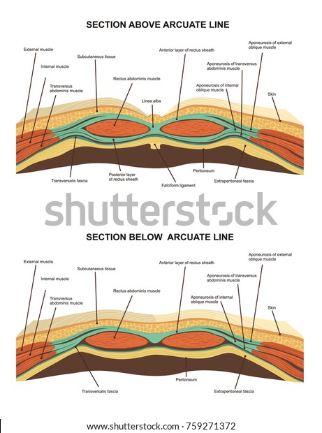 Muscles Cross Section Anterior Abdominal Wall Stock Vector (Royalty ...