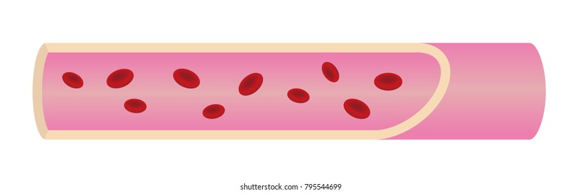 Cartoon Illustration Healthy Blood Vessel 库存矢量图（免版税）795685585 ...