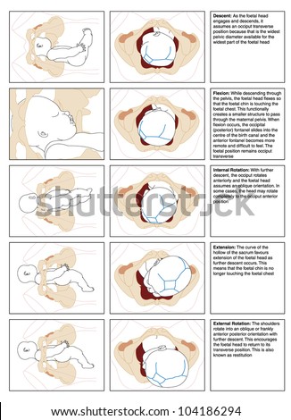 Normal Birth Showing Detail Fetal Movement stockvector (rechtenvrij ...