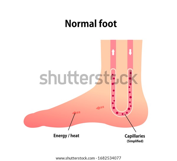 Normal Foot Blood Circulation Illustration Stock Vector (Royalty Free ...