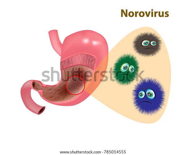 Norovirus Winter Vomiting Bug Stock Vector (Royalty Free) 785014555 ...