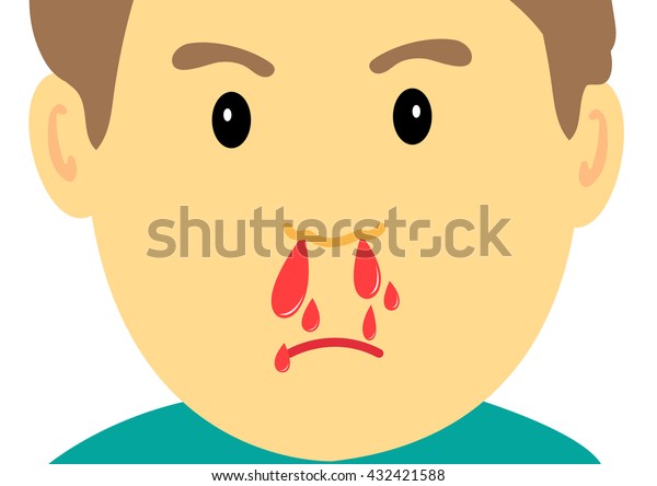 Nosebleedvector Illustration Stock Vector (Royalty Free) 432421588 ...