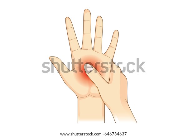 Numbness One Hand Illustration About Loss Stock Vector (Royalty Free ...