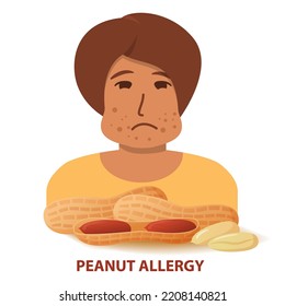 Nut Allergy Symptoms Problem Swollen Man Stock Vector (Royalty Free ...