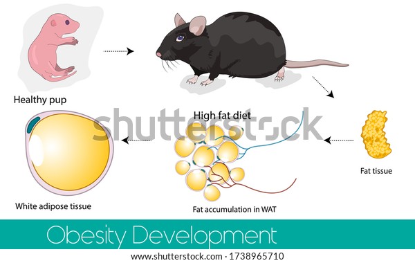 Obesity Disease Mechanism Development Model Using Stock Vector (Royalty ...