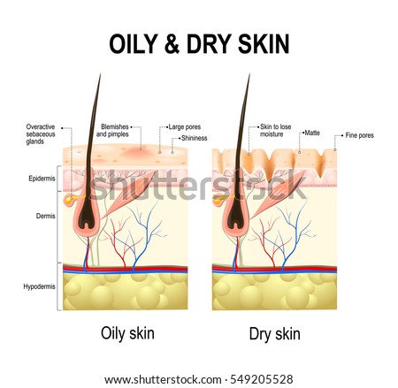 Oily Dry Skin Different Human Skin 스톡 벡터(사용료 없음) 549205528 - Shutterstock