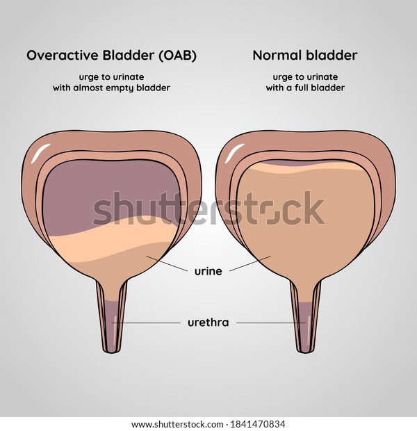 811 imagens de Normal bladder Imagens, fotos stock e vetores | Shutterstock
