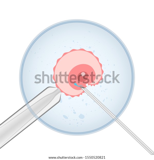 Ovum Sperm On Needle Under Microscope Stock Vector (Royalty Free ...