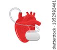 8+ Thousand Pacemaker Royalty-Free Images, Stock Photos & Pictures ...