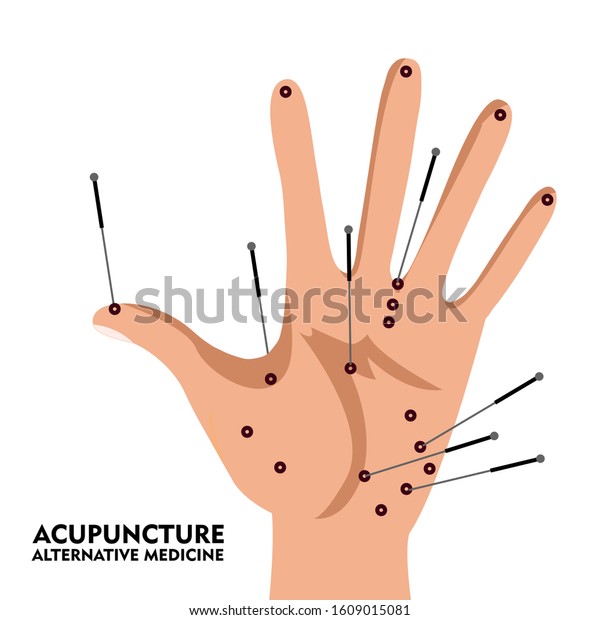 Palm Acupuncture Points Scheme Cartoon Style Stock Vector (Royalty Free ...
