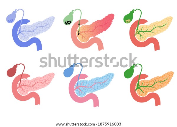 Pancreas Duodenum Gallbladder Anatomy Logo Set: Vector có sẵn (miễn phí ...